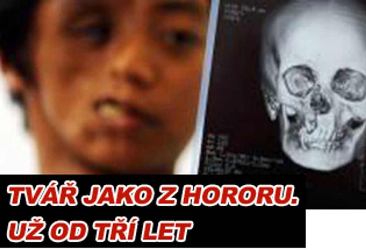 Tvář jako z hororu. Už od tří let | TN.cz