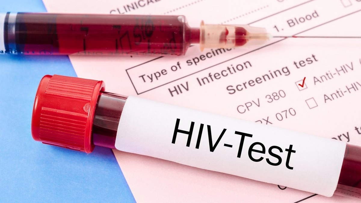 V části Evropy roste počet případů HIV. Výskyt viru eviduje i Česko | TN.cz