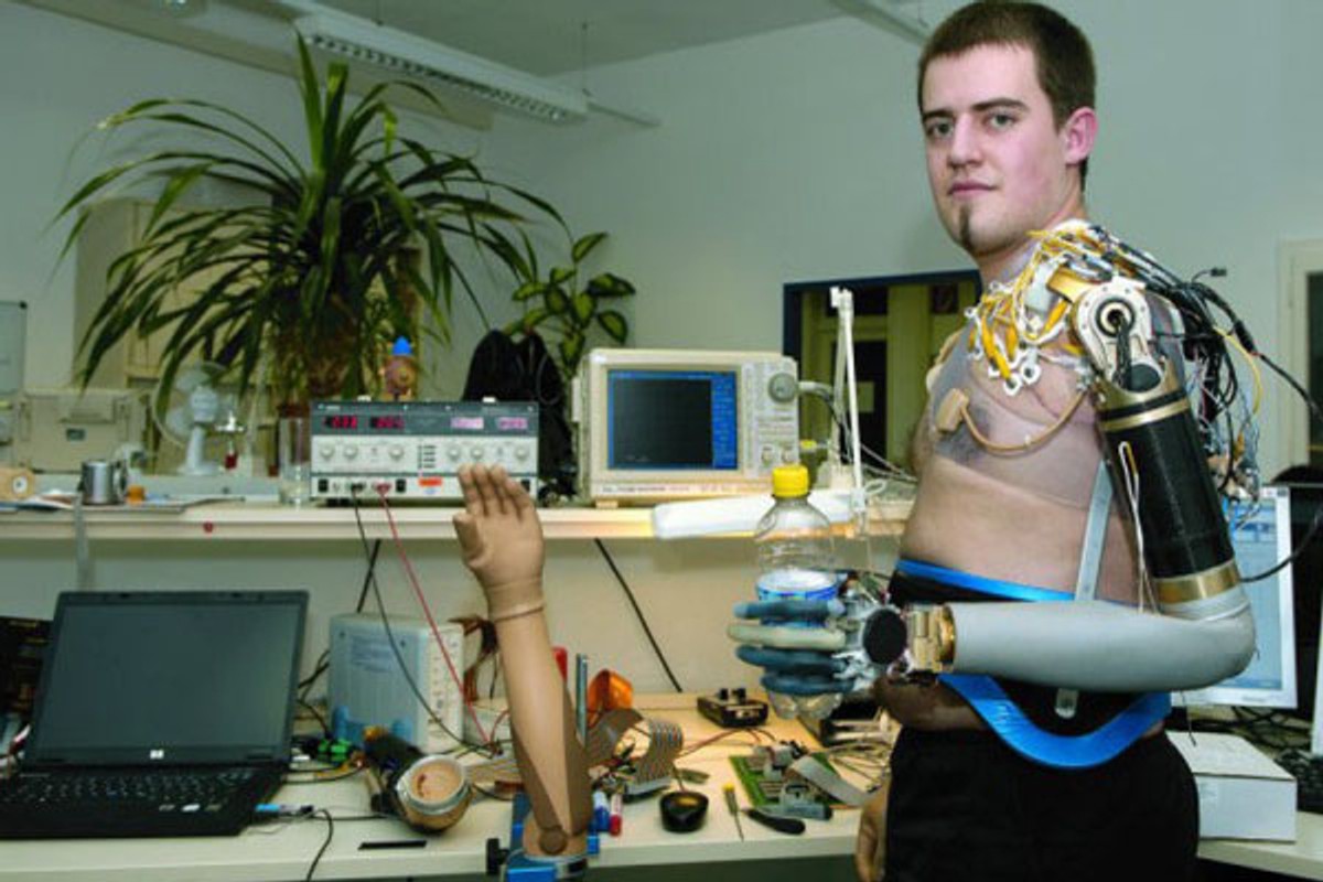 Ruce má jako robot. Protézy řídí myšlenkami | TN.cz